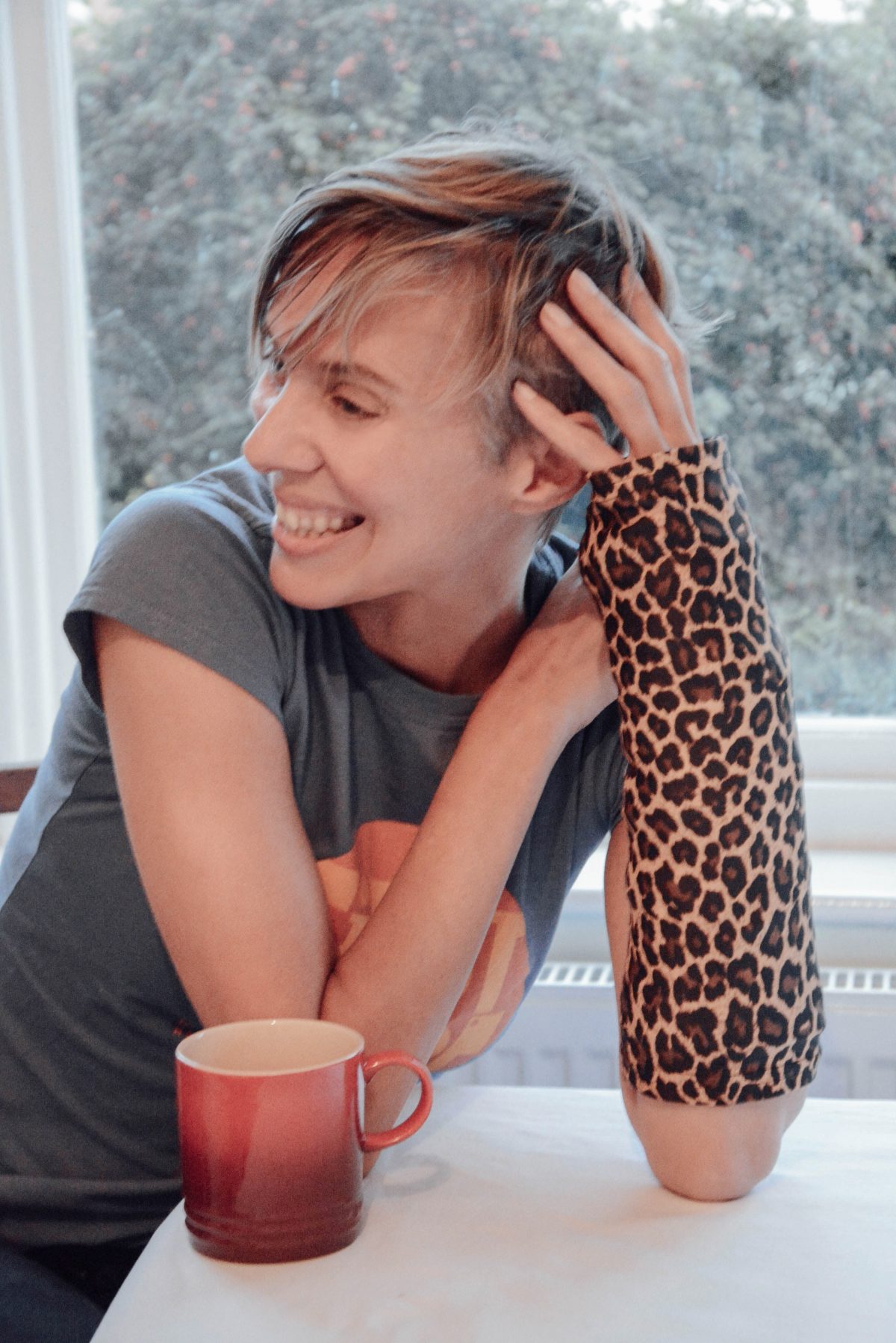 Decorative arm cast covers | Supersleeves cast covers